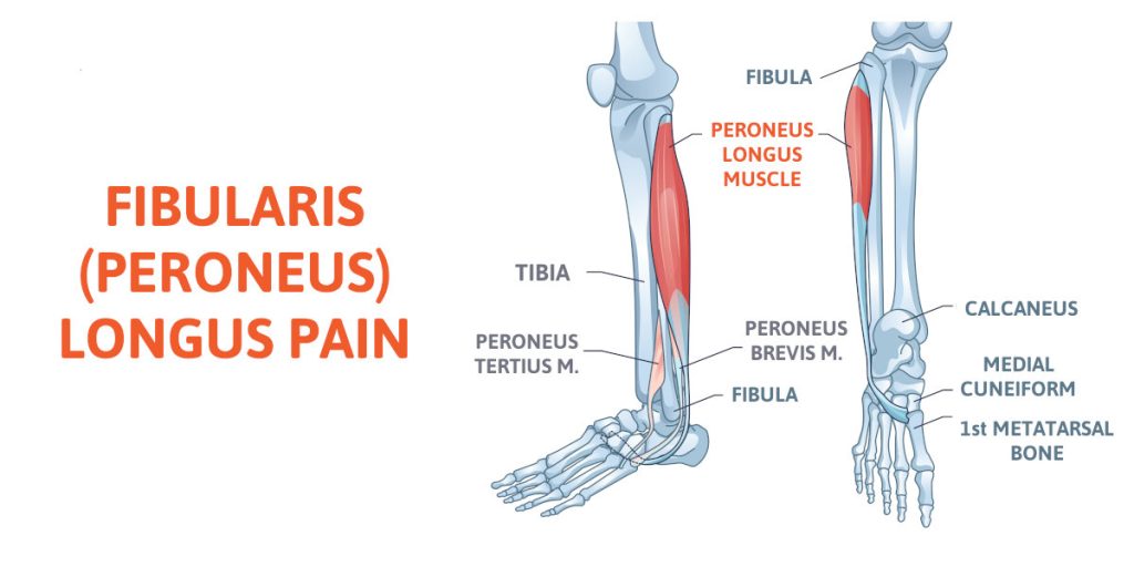 Fibularis longus pain needs to be properly evaluated!