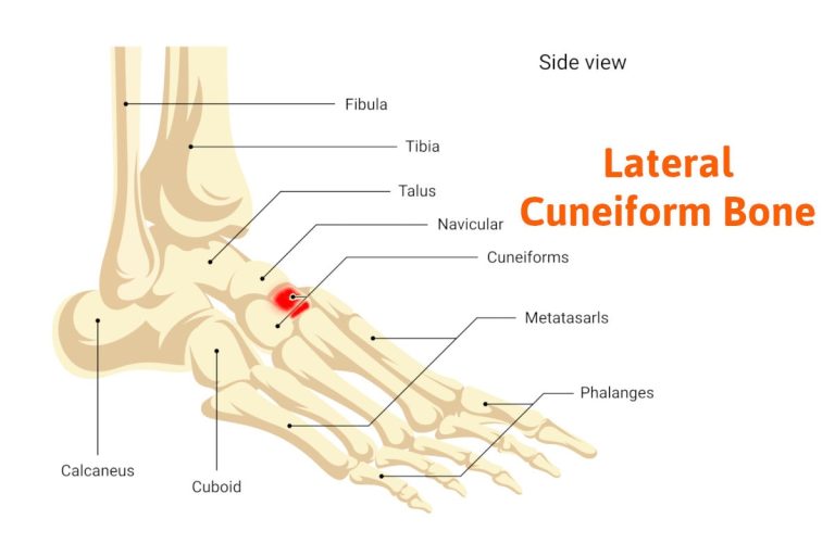 Lateral cuneiform bone, know the importance for your foot.